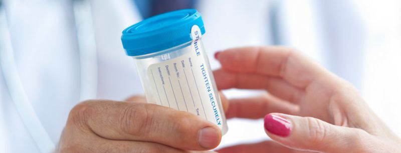 False Positives Drug Test Information